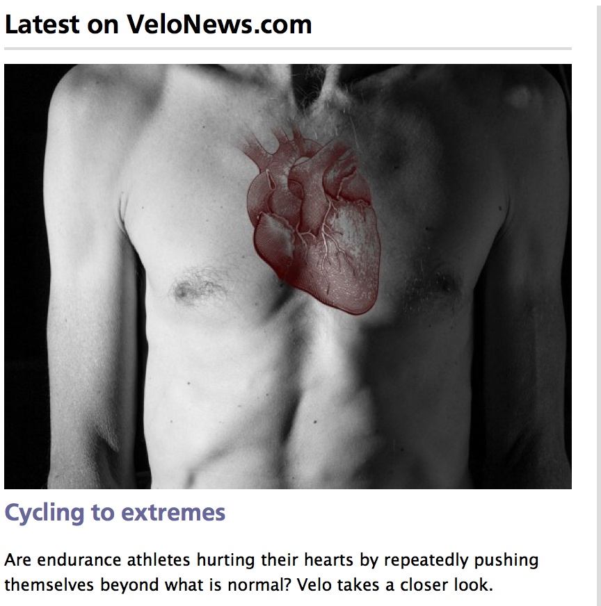 The cardiac dangers of excess exercise – Dr John M