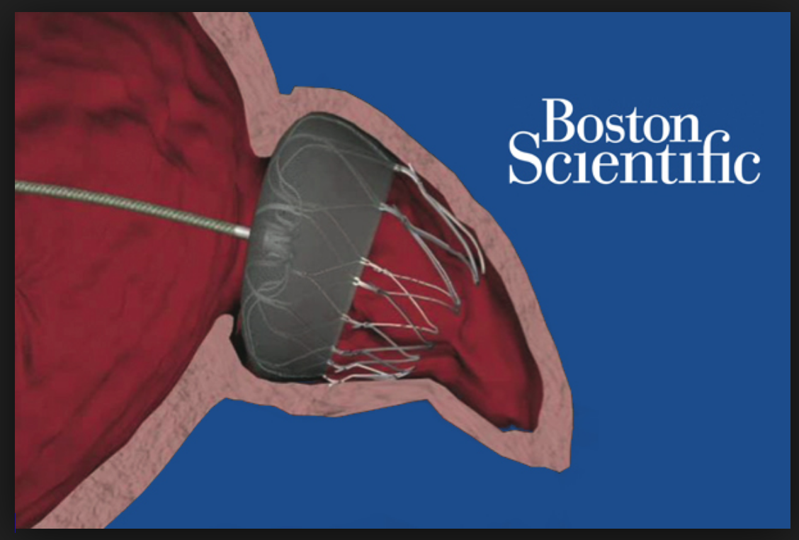 Say No to Watchman – Dr John M